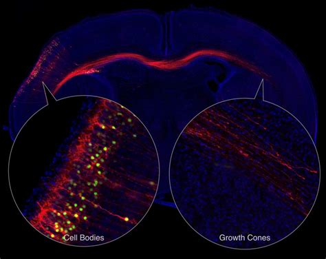 Labeled Callosal Projection Neurons Bioserendipity