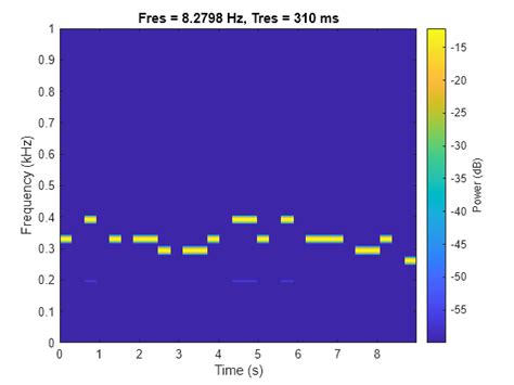 Bandpass Bandpass Filter Signals Matlab