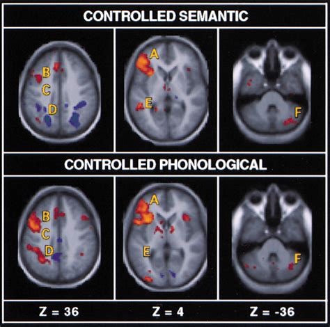 Common Prefrontal Regions Coactivate With Dissociable Posterior Regions During Controlled