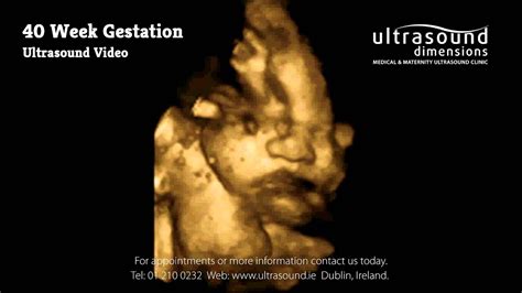 40 Weeks Pregnant Ultrasound Cervical Pregnancy Scan 16 40 Weeks At