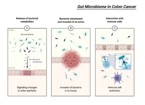 Gut Microbiome In Colon Cancer Biorender Science Templates