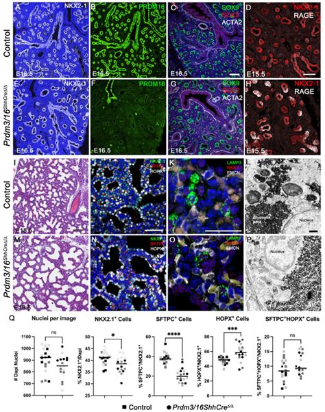 Prdm316 Regulate Chromatin Accessibility Required For Nkx2 1 Mediated