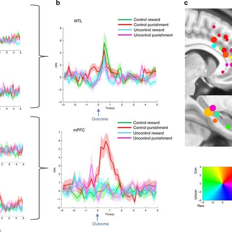 Example Neural Responses To The Different Outcome Conditions A Sagittal