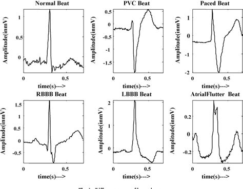 Figure 1 From Correlation Technique And Least Square Support Vector Machine Combine For