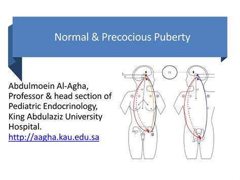 Puberty Normal And Precocious Pdf