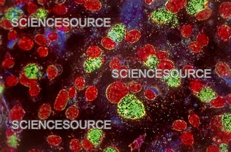 Chlamydia Infected Culture Under A Mic Stock Image Science Source Images