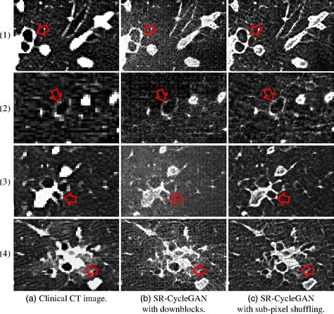 Sr Cyclegan Super Resolution Of Clinical Ct To Micro Ct Level With Multi Modality Super