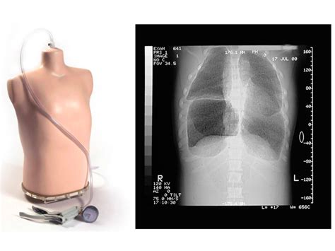 3 dimensional torso phantom pocl medical solutions