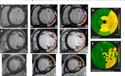 Figure 1 From Current Insights And Novel Cardiovascular Magnetic Resonance Based Techniques In