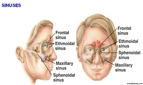 Maxillary Sinus Disease Pptx دوفاء Muhadharaty