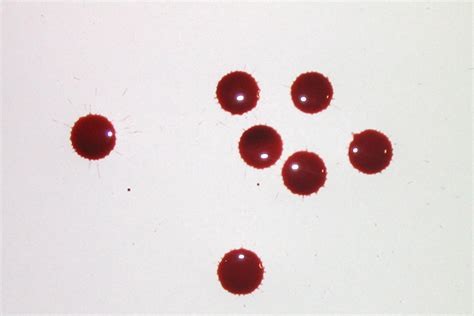 Passive Drop Bloodstain Pattern Analysis Terminology Iabpa Hemospat