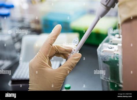 Western Blot Analysis Use As Protein Analysis For Protein Detection