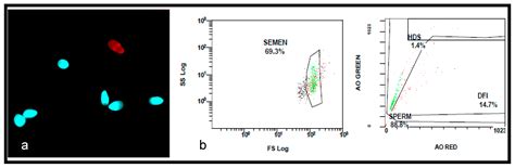 Evaluation Of Sperm Dna Fragmentation Using Two Different Methods