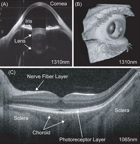 1065nm And 1310nm Mems Tunable Vcsel Light Source Technology For Oct Imaging