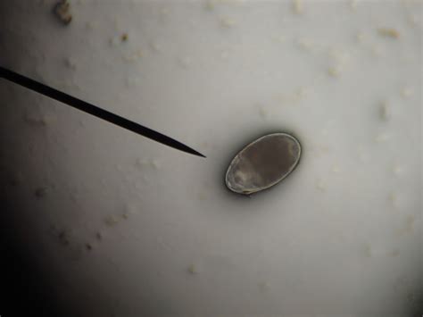 Ear Mite Egg In Debris From A Cats Ear 100x