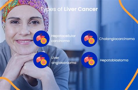 Liver Cancer Everything You Need To Know Actc