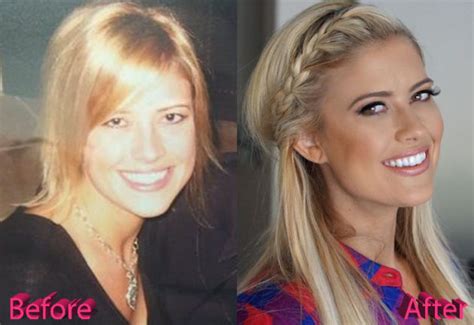 Christina El Moussa Plastic Surgery Still Beautiful