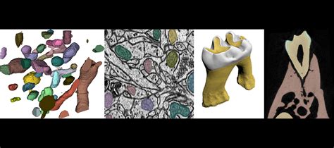 Via Webinar Semi Automated Segmentation Of Biological Images With Biomedisa And 3d Slicer