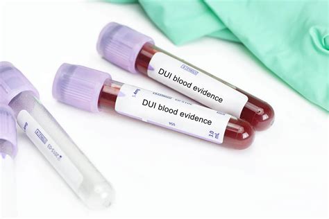 What Shows Up On A Dui Blood Test At Norris Carrico Blog