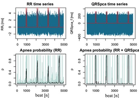 Top Normalized Rr And Qrspca Time Series Blue Color And Apnea