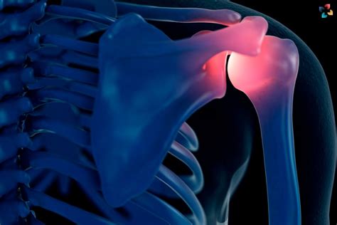 Glenoid Labrum Tear Shoulder Joint Tear Symptoms Causes Treatment And Recovery The