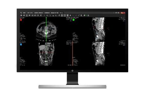 Suitestensa Univiewer Web Module
