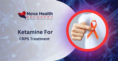 Crps Treatment In Alexandria Va Instant Relief