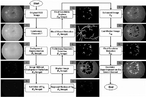 Summarized Steps To Detect The Exudates Lesions According Our Approach Download Scientific