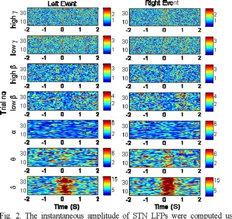 Figure 1 From A Robust Strategy For Decoding Movements From Deep Brain Local Field Potentials To