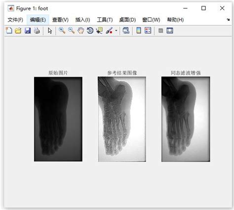 【b29】基于matlab医学图像增强使用同态滤波的方法 图像处理 索炜达电子