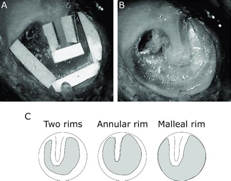 Tm Before And After Perforation A Tm With 1 Mm Paper Patches Applied Download Scientific