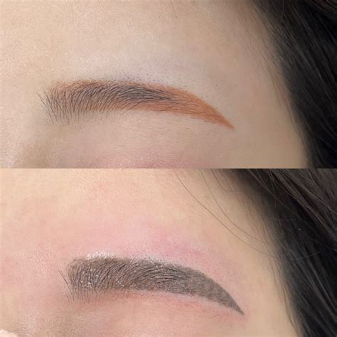 서울대입구 눈썹 문신 붉은 잔흔 레이저 제거 2회차 찐 후기 네이버 블로그