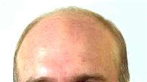 Carl Rackemann Photos Image Gallery And Match Pictures