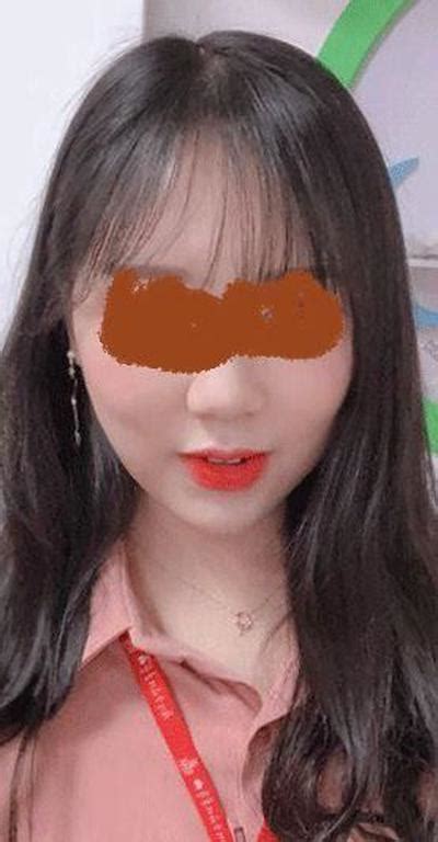 실리프팅 시술방법 선택 안함 시술・수술후기 By 동굴동굴해 바비톡