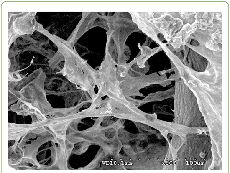 Scanning Electron Microscopy Of The Bone Graft After Decellularization