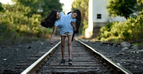 What 17 Year Old Conjoined Twins Carmen And Lupita Andrade Look Like