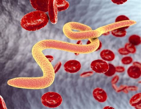 Intestinal Worm Infection Can Cause Severe Sexually Transmitted Viral
