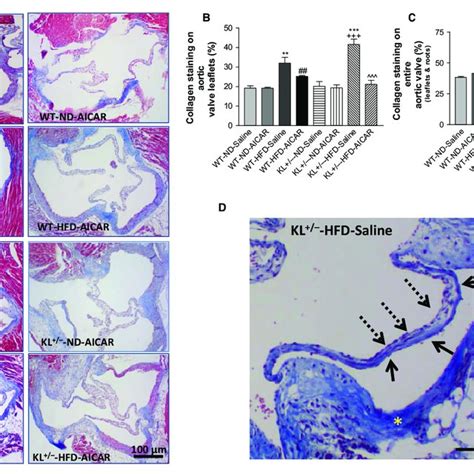 Klotho Deficiency Increased Runx2 Expression In Aortic Valves Via