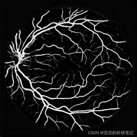 Unet Pytorch 胎教级介绍 使用drive眼底血管分割数据集进行入门实战pytorch浩浩的科研笔记 北京朝阳ai社区