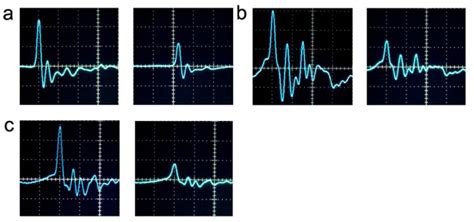 Linear And Nonlinear Pa Effects In Chylomicron Phantoms And Cells In Download Scientific