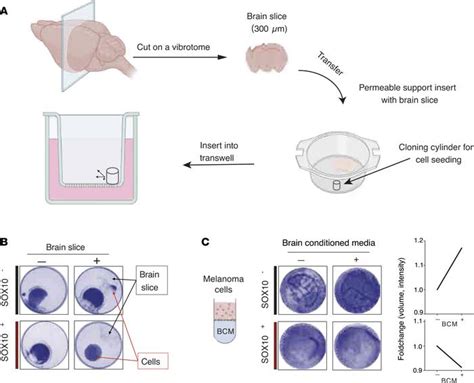 Jci Insight Dna Promoter Hypermethylation Of Melanocyte Lineage Genes