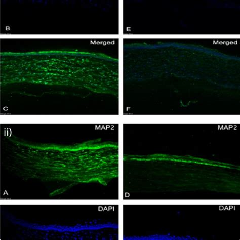 In Vivo Results Rat Cornea Sections Labelled For Structural Neuronal
