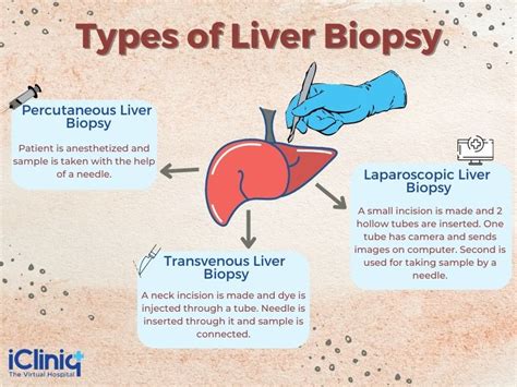 Liver Biopsy Procedure