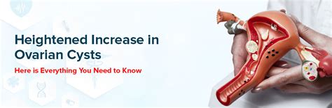 Heightened Increase In Ovarian Cysts Here Is Everything You Need To Know Ganesh Diagnostic