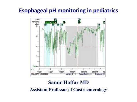 Esophageal Ph Monitoring In Pediatrics Pptx