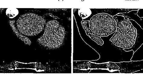 Figure 2 From Segmentation Of Biomedical Images With Eigenvectors