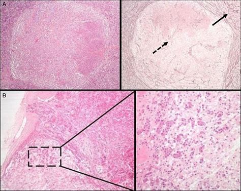 Pituitary Histology Labeled Pituitary Histology Filepituitary