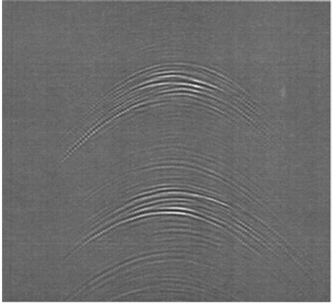Figure 5 From The Detection Of Breast Microcalcifications With Medical Ultrasound Semantic