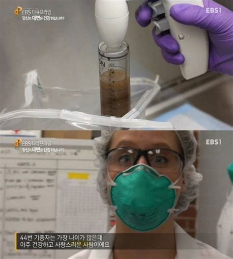 대변 이식수술 지식의정석 New