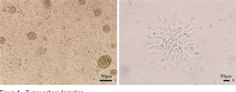Figure 1 From The Cultivation And Identification Of Tumor Stem Cells From Neuroblastoma Derived